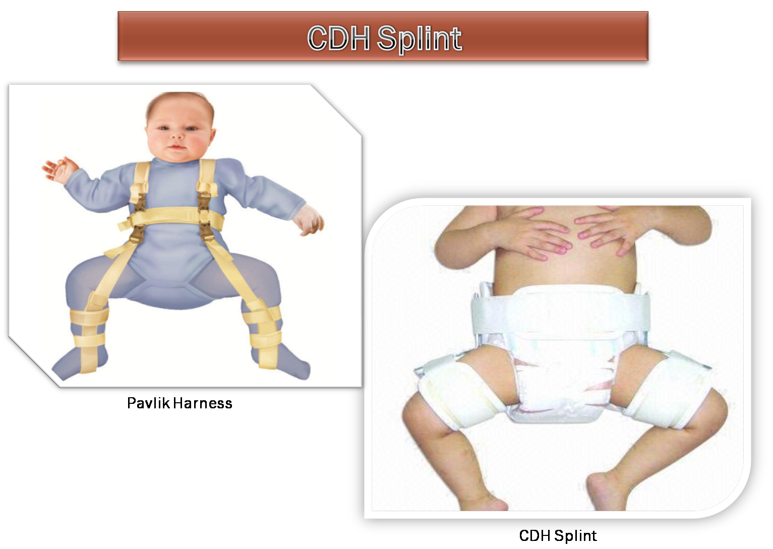 Orthotic Prosthetic Orthopedic & Diabetic – Creative Orthotic and ...